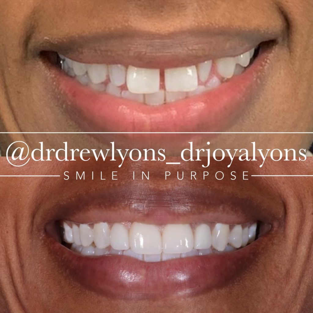 Smile Savvy Cosmetic Dentistry - Charlotte, NC