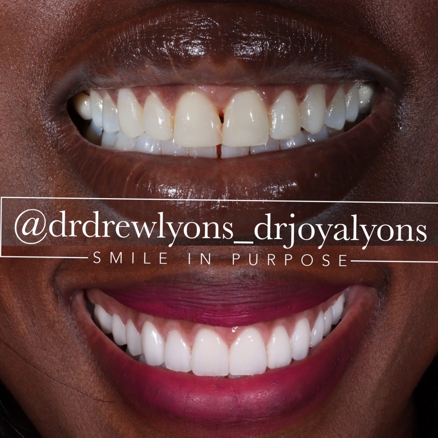 Smile Savvy Cosmetic Dentistry - Charlotte, NC